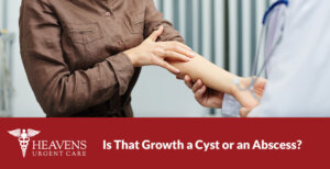 Is that growth a cyst or an abscess? | Heavens Urgent Care Apache Junction